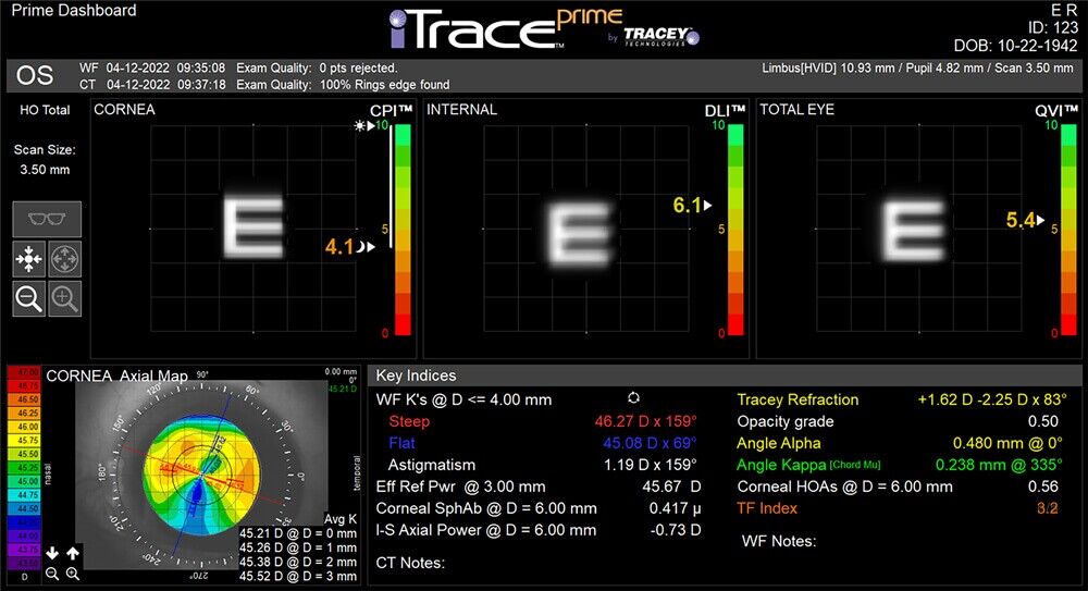 iTrace Prime | Tracey Technologies